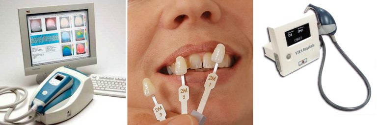 Shade Matching | Pro-Art Dental Laboratory | Where Art & Science Meet